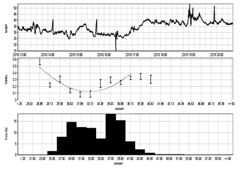 Study of Autoregulation Monitoring in BAbies (SAMBA study) – neoLab